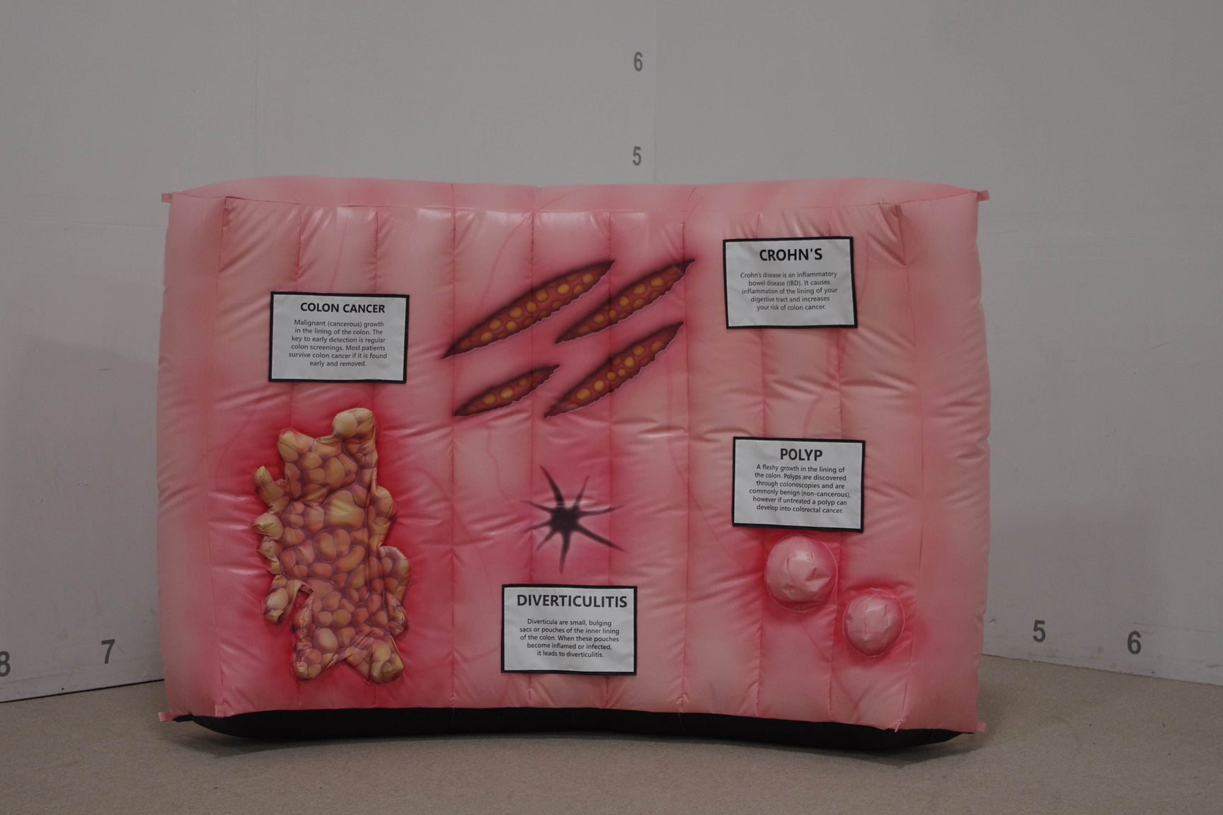 Inflatable Colons – The Alliance Shop